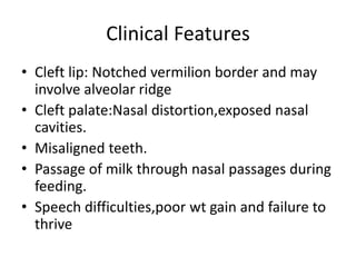 CLEFT LIP AND CLEFT PALATE.pptx in children | PPTX