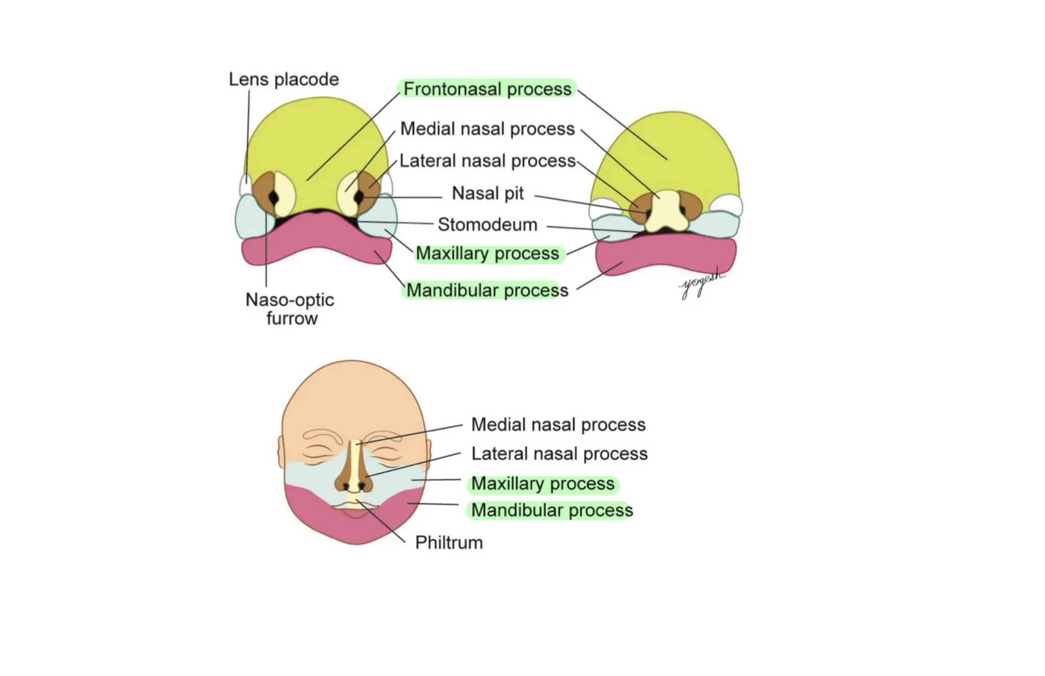 Cleft Lip And Cleft Palate.pdf.......... | PDF