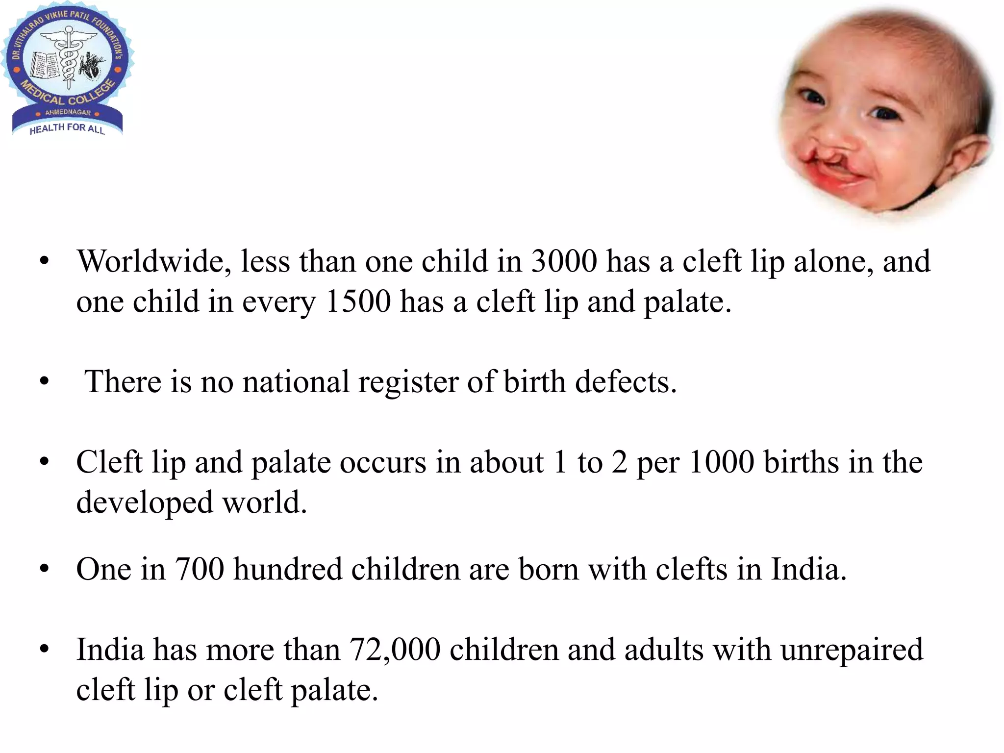 Cleft lip and cleft palate in children | PPT