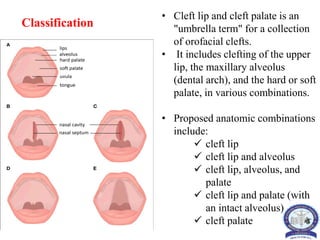 Cleft lip and cleft palate in children | PPTX