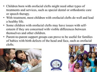 Cleft lip and cleft palate in children | PPTX