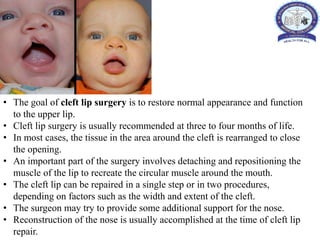 Cleft lip and cleft palate in children | PPTX