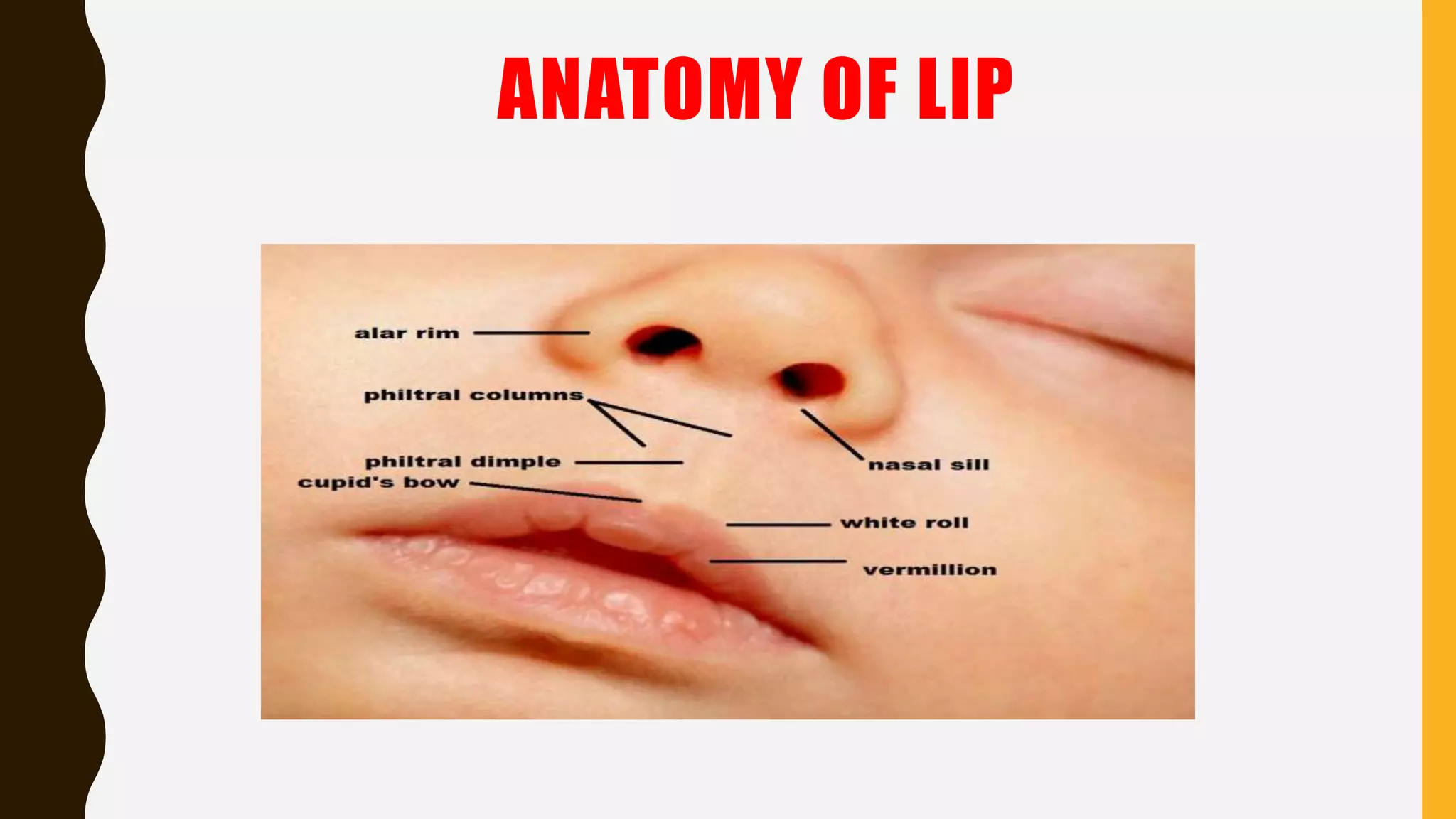 Cleft lip and cleft palate ppt | PPTX