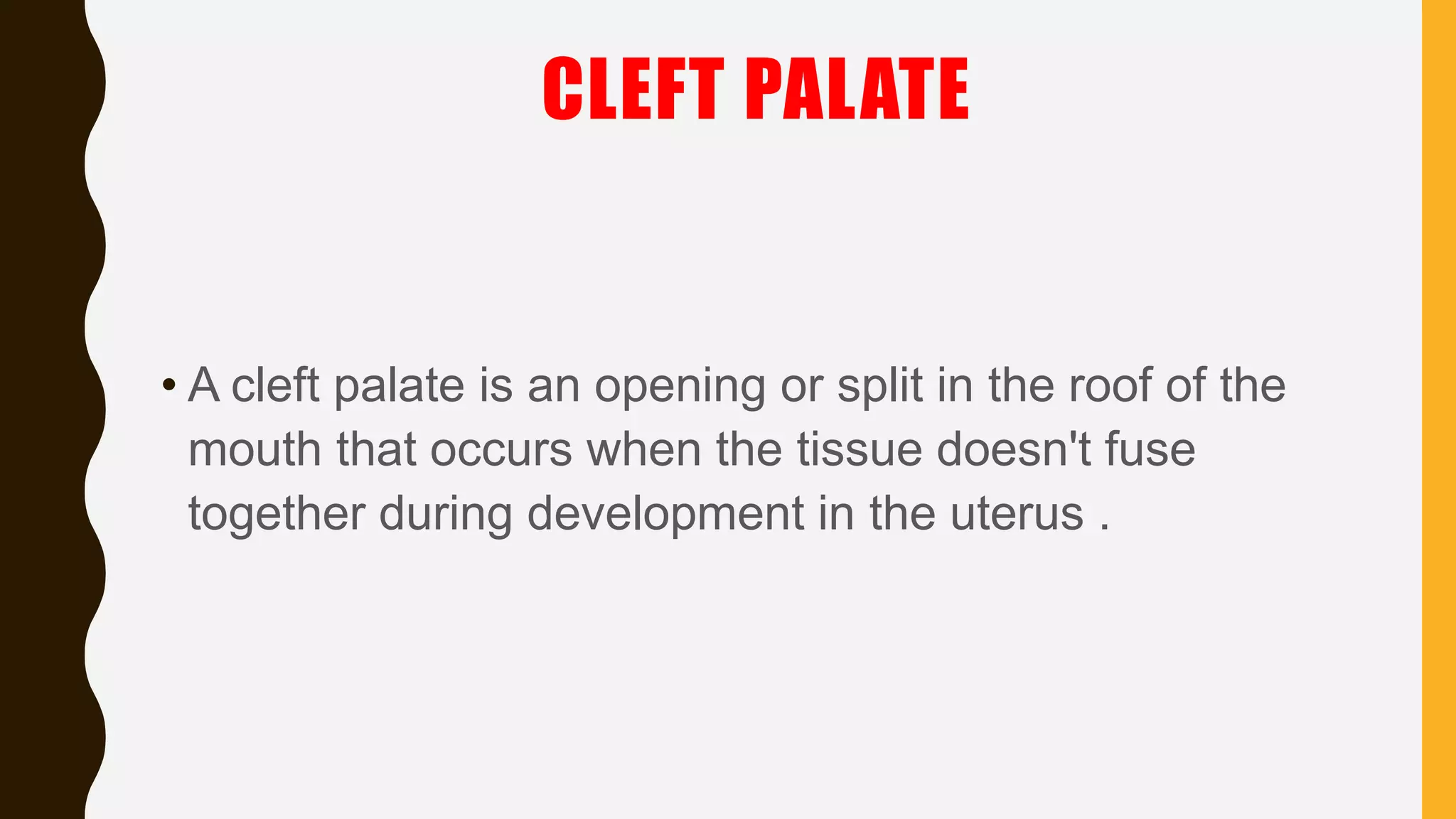 Cleft lip and cleft palate ppt | PPTX