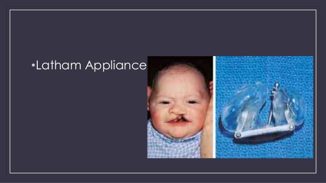 Cleft lip and palate