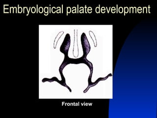 Cleft lip and palate | PPT