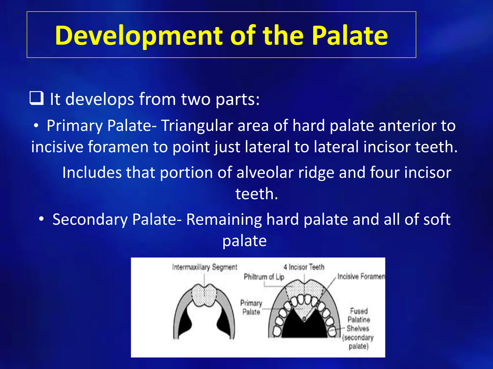 Cleft lip and palate | PPTX