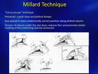 Cleft lip and palate | PPT