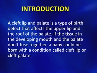 Cleft lip and palate | PPTX