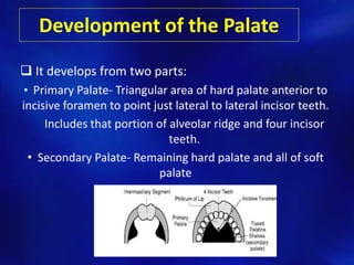 Cleft lip and palate | PPTX