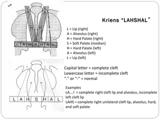 Cleftlipandpalate | PPT