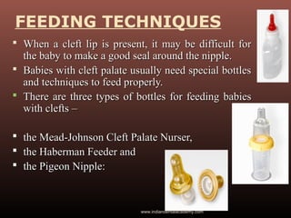 Cleft lip and palate/prosthodontic courses | PPT