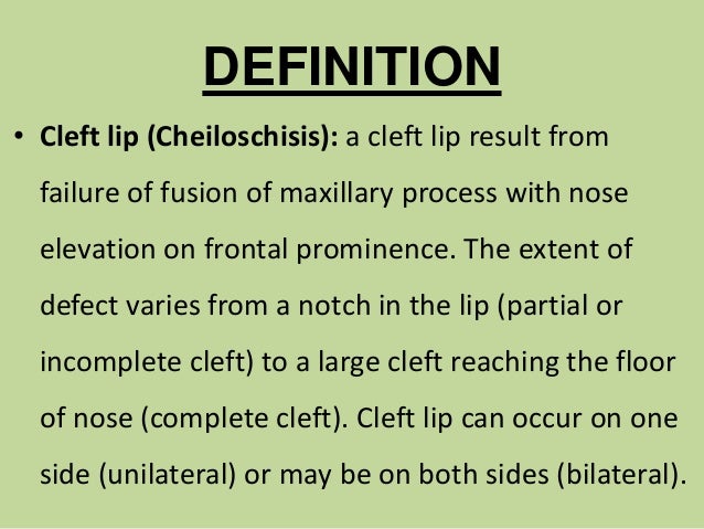 Palatable Definition