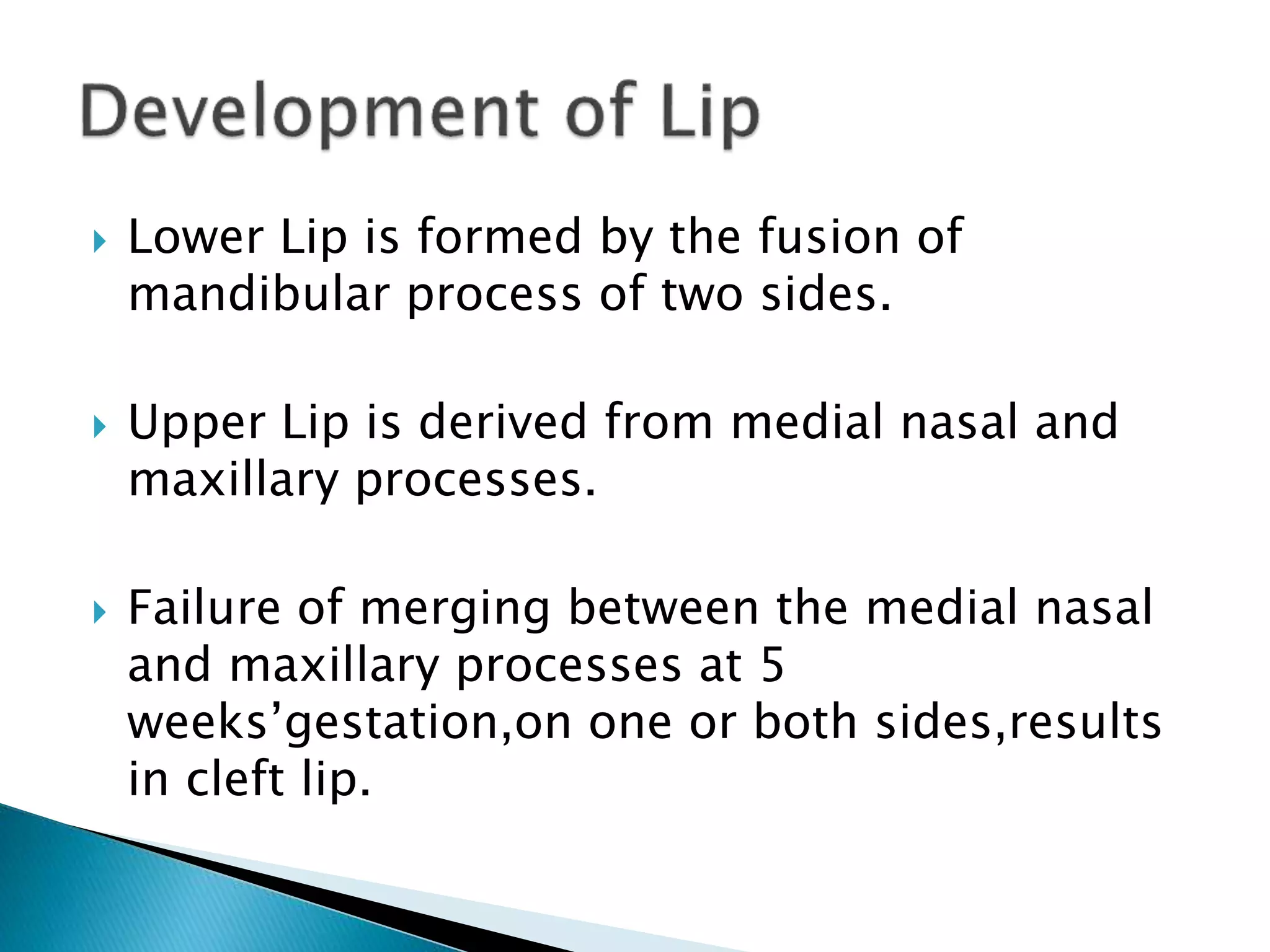 Cleft lip and palate | PPTX