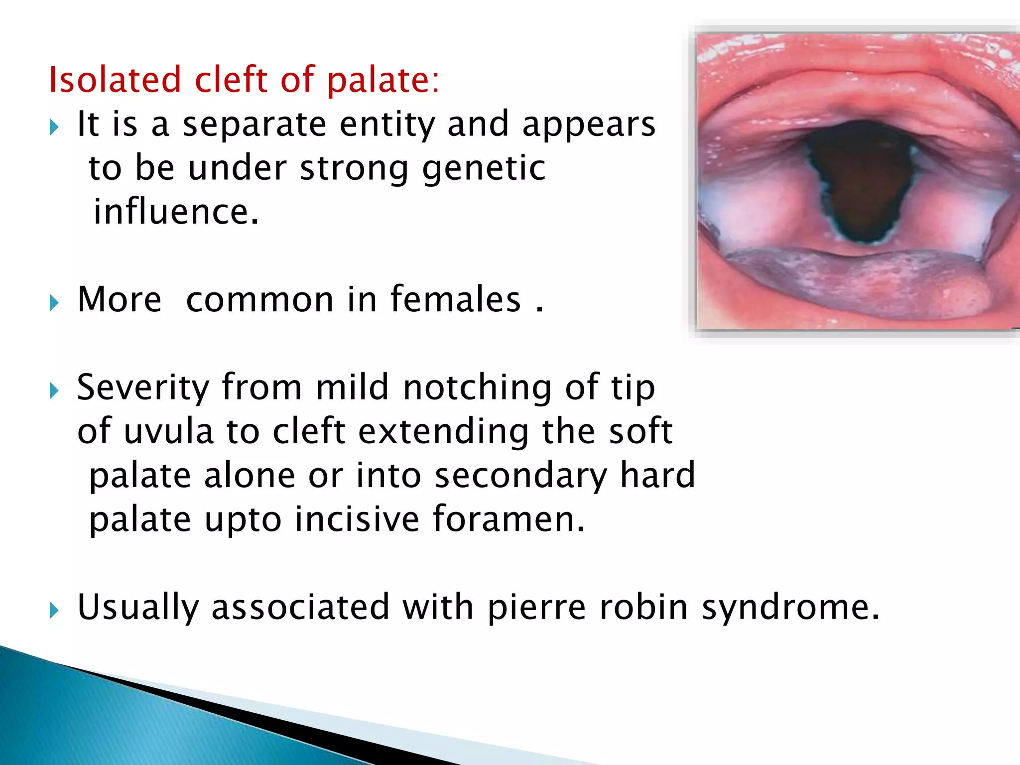 Cleft lip and palate | PPTX