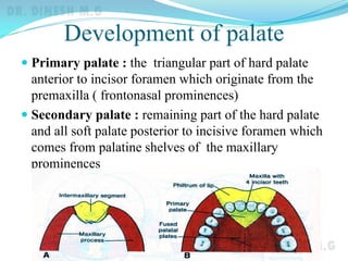 Cleft lip and palate | PPT