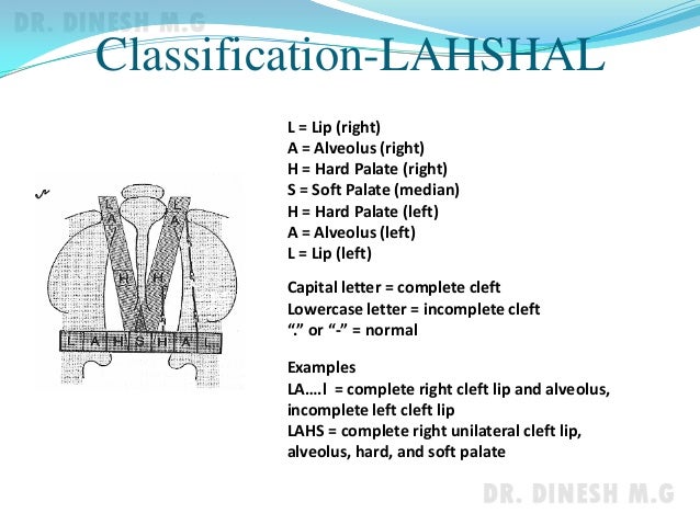 Cleft lip and palate