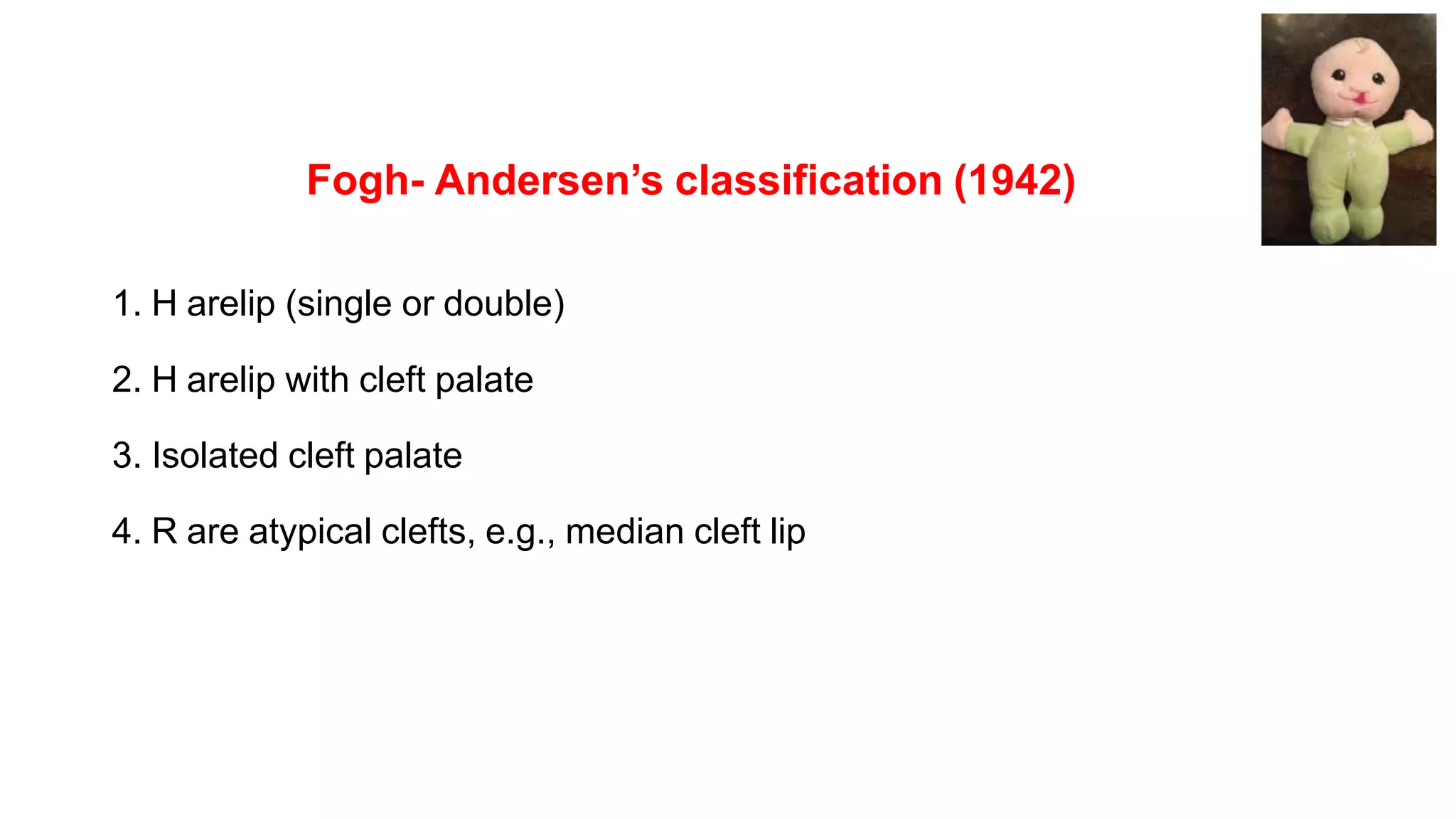 Cleft lip and palate | PPTX