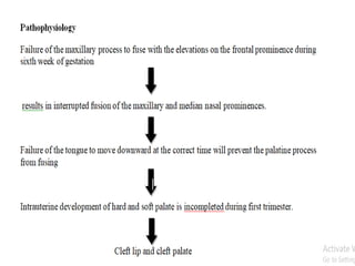 Cleft lip and palate | PPTX