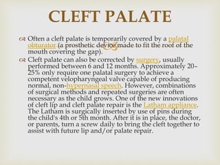 Cleft lip and palate | PPTX