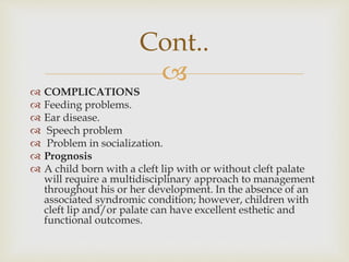 Cleft lip and palate | PPTX