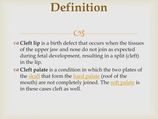 Cleft lip and palate | PPTX