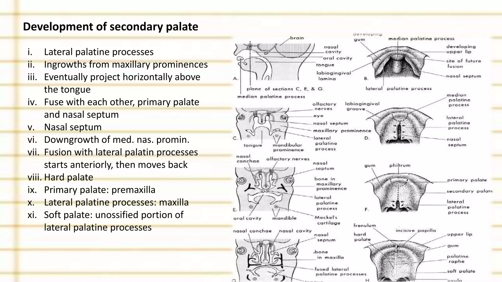 Cleft lip and palate | PPTX