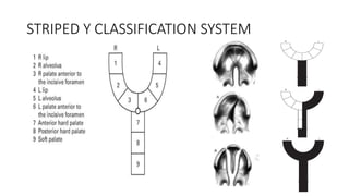 Cleft lip and palate | PPTX