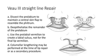Cleft lip and palate | PPTX
