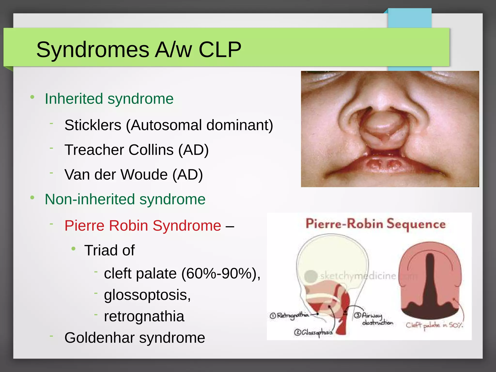Cleft Lip and Palate | PDF