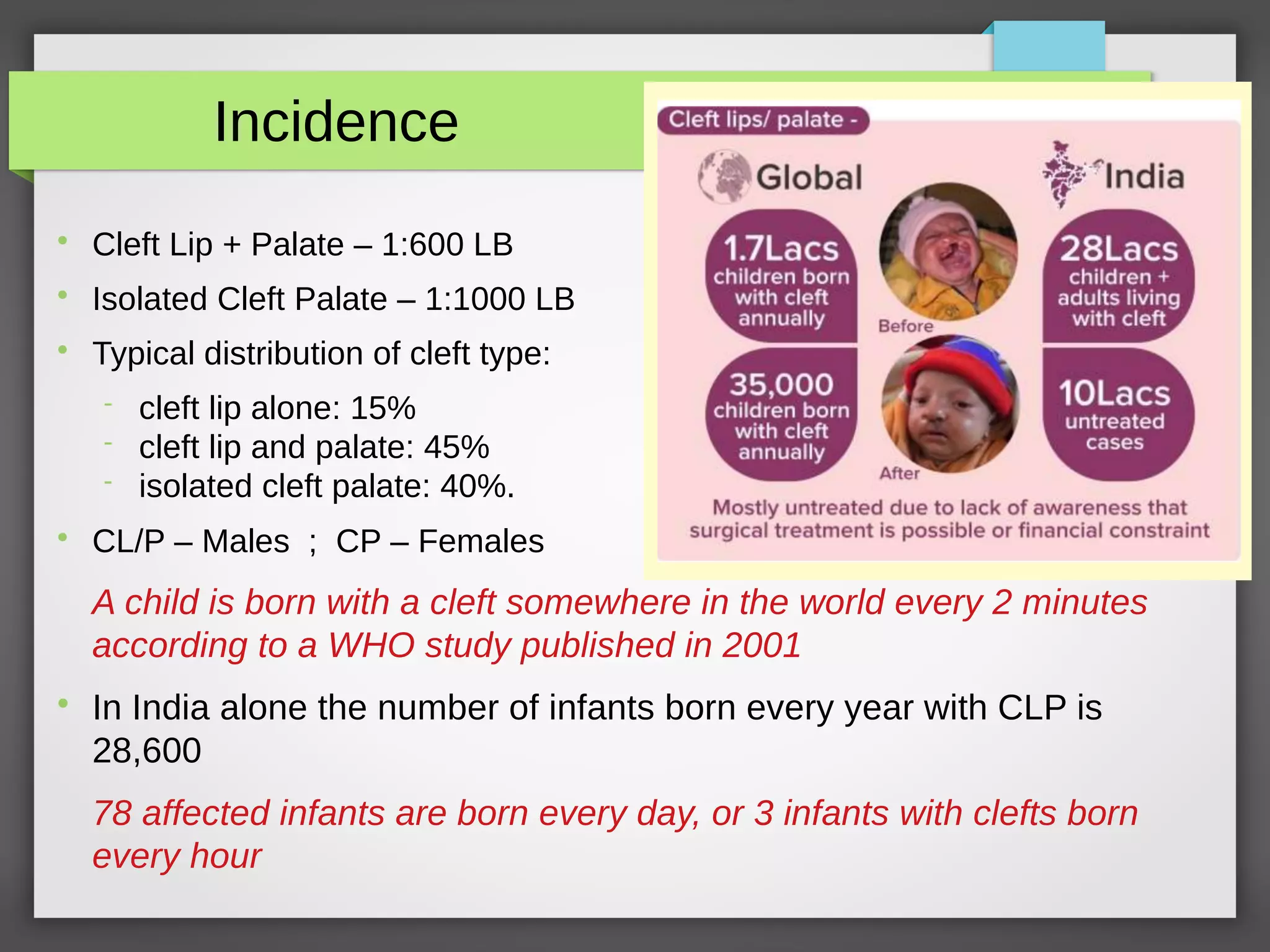 Cleft Lip and Palate | PDF
