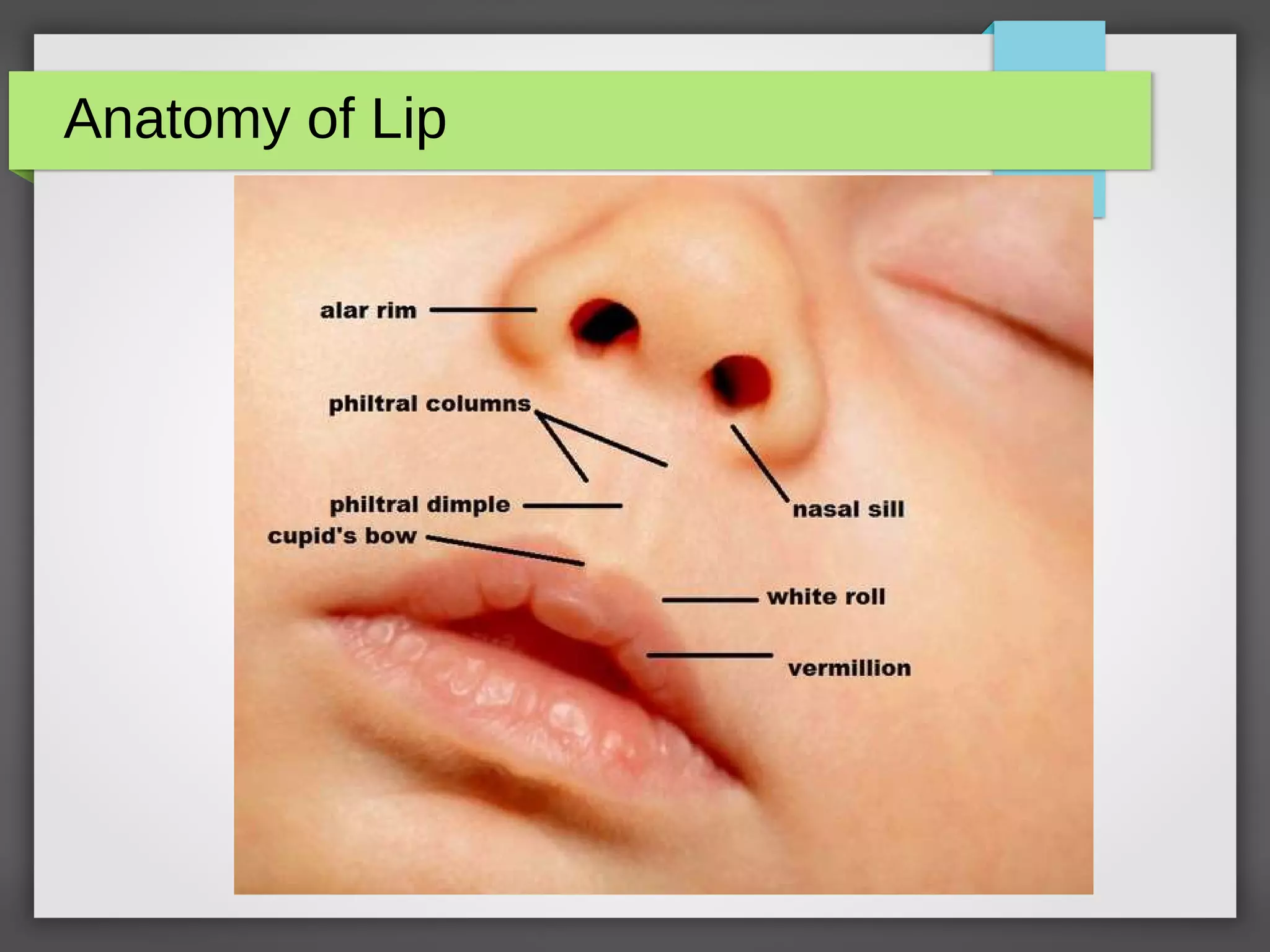 Cleft Lip and Palate | PDF