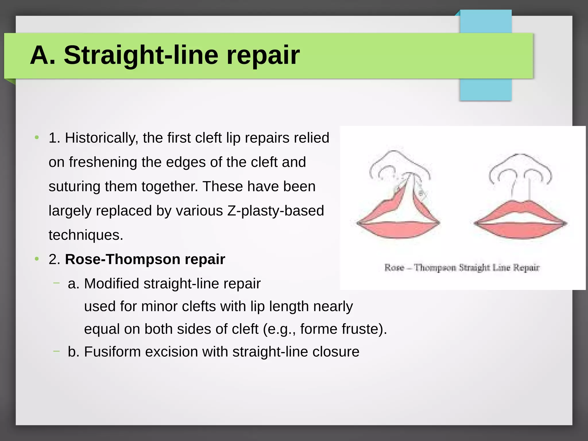 Cleft Lip and Palate | PDF