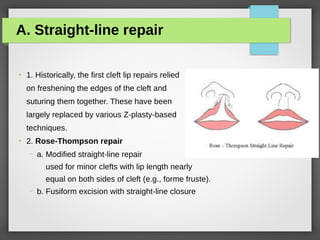 Cleft Lip and Palate | PDF