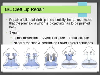 Cleft Lip and Palate | PDF
