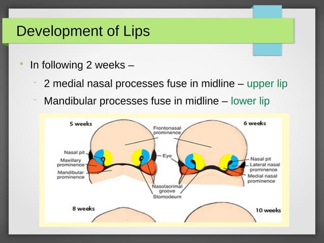 Cleft Lip and Palate | PDF