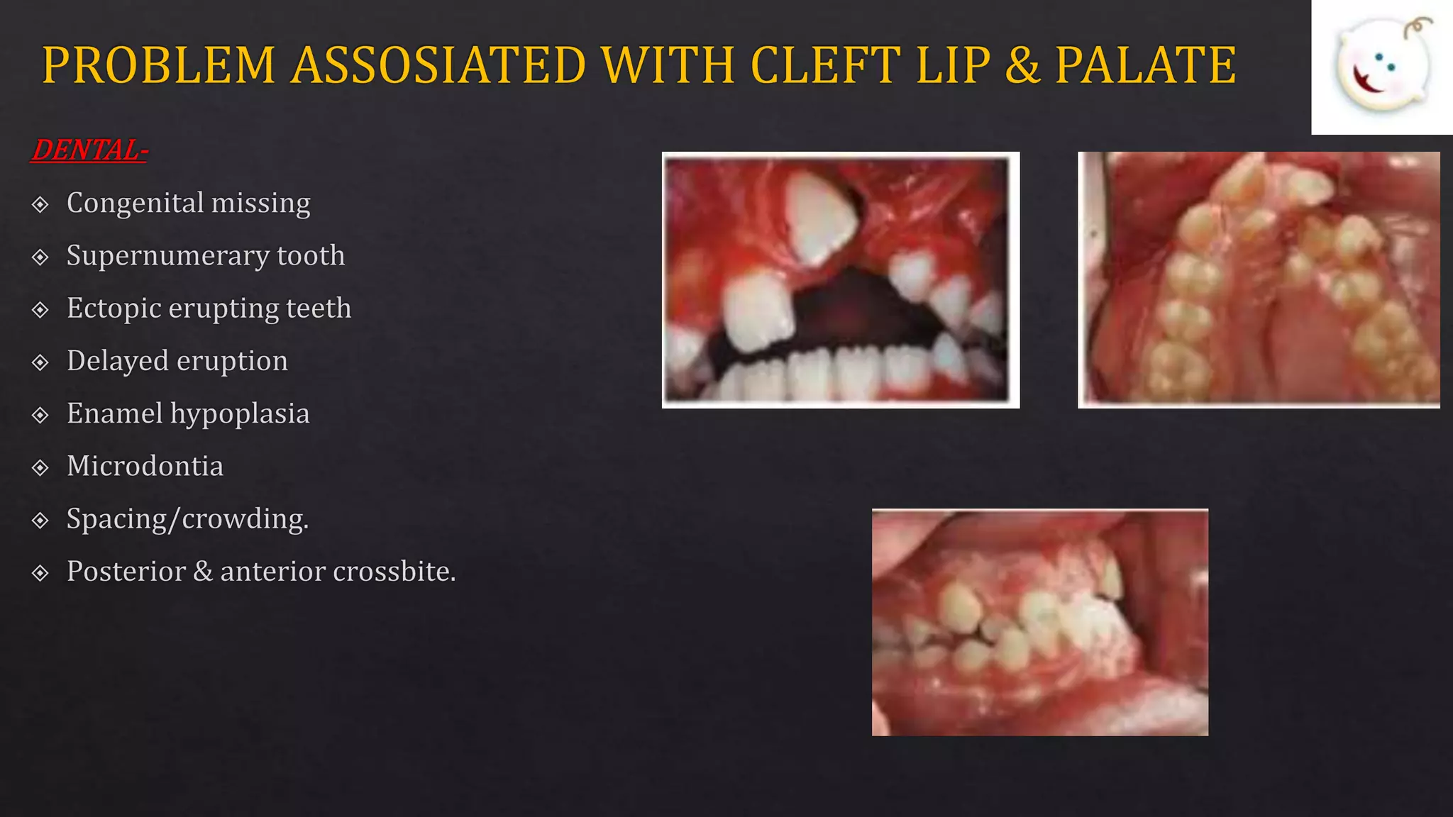 Cleft lip and palate | PPTX | Ear, Nose and Throat Conditions ...