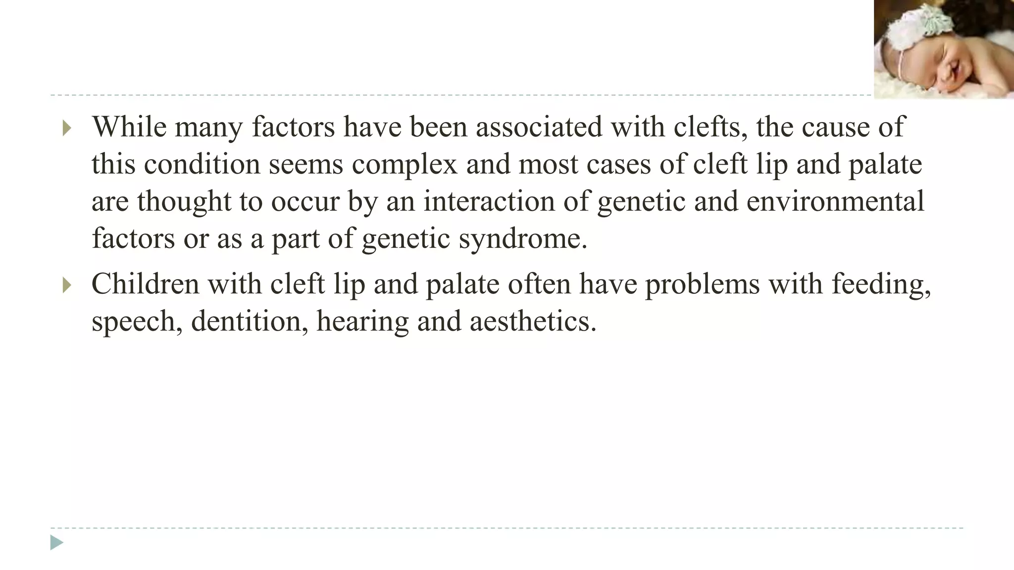 Cleft lip and palate | PPTX