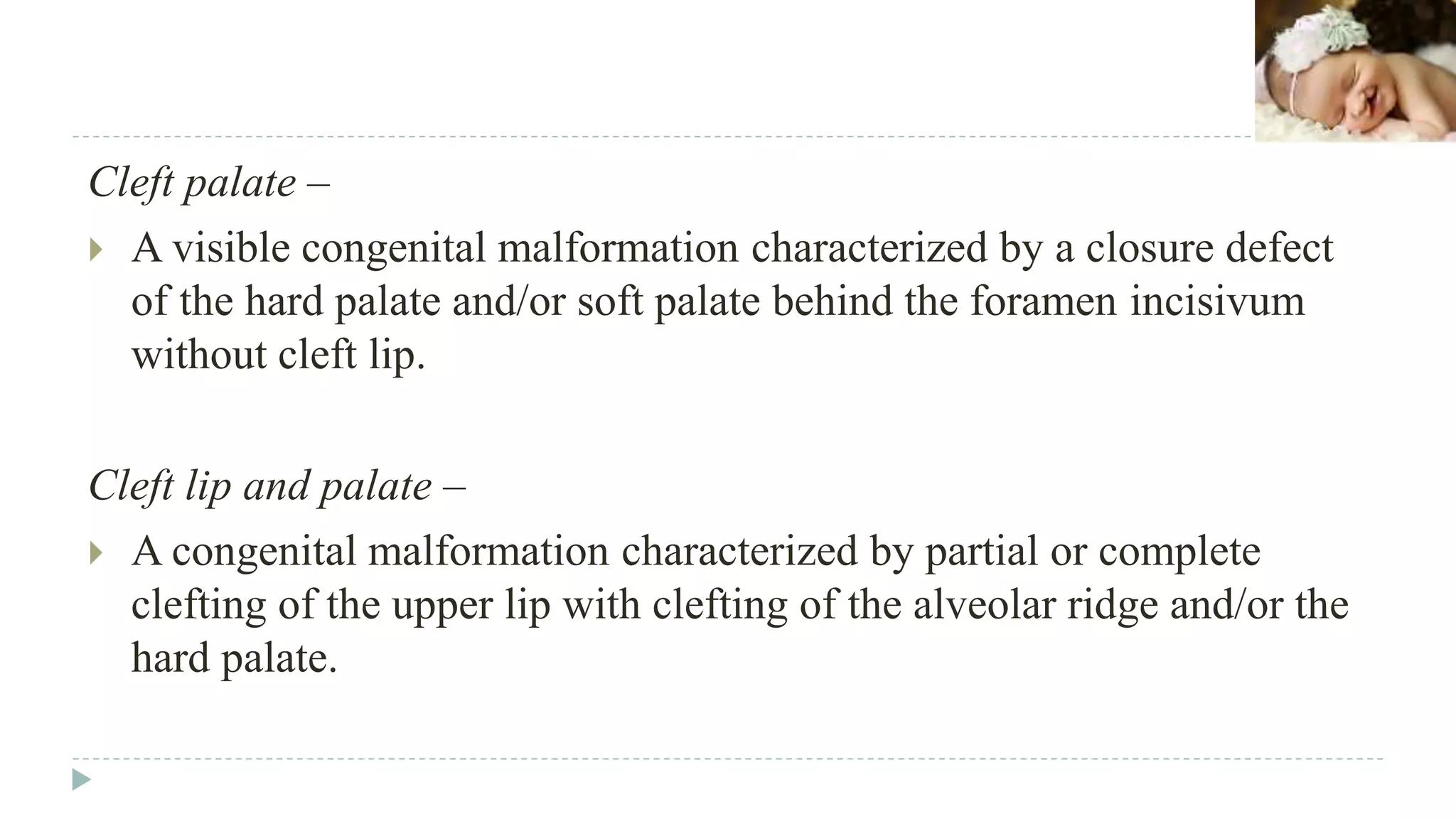 Cleft lip and palate | PPTX
