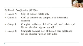 Cleft lip and palate | PPTX