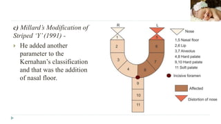 Cleft lip and palate | PPTX