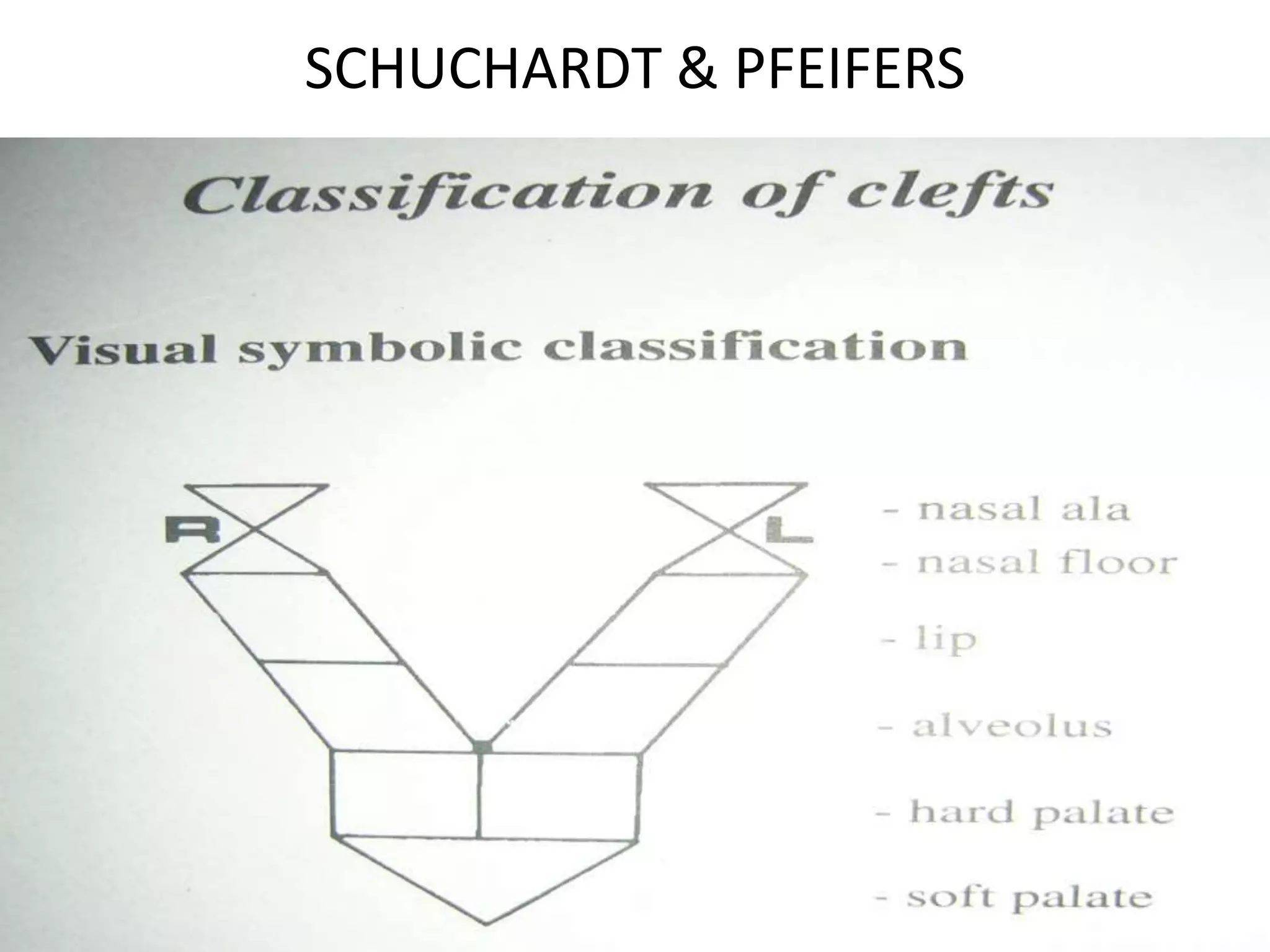 CLEFT LIP AND PALATE.pptx
