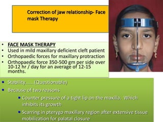 CLEFT LIP AND PALATE.pptx