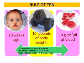 CLEFT LIP AND PALATE.pptx