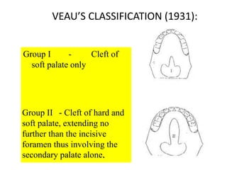 CLEFT LIP AND PALATE.pptx