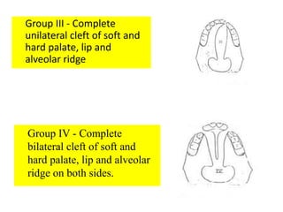 CLEFT LIP AND PALATE.pptx