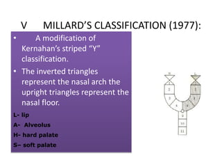 CLEFT LIP AND PALATE.pptx