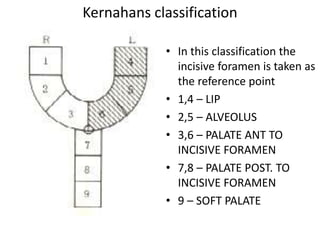 CLEFT LIP AND PALATE.pptx