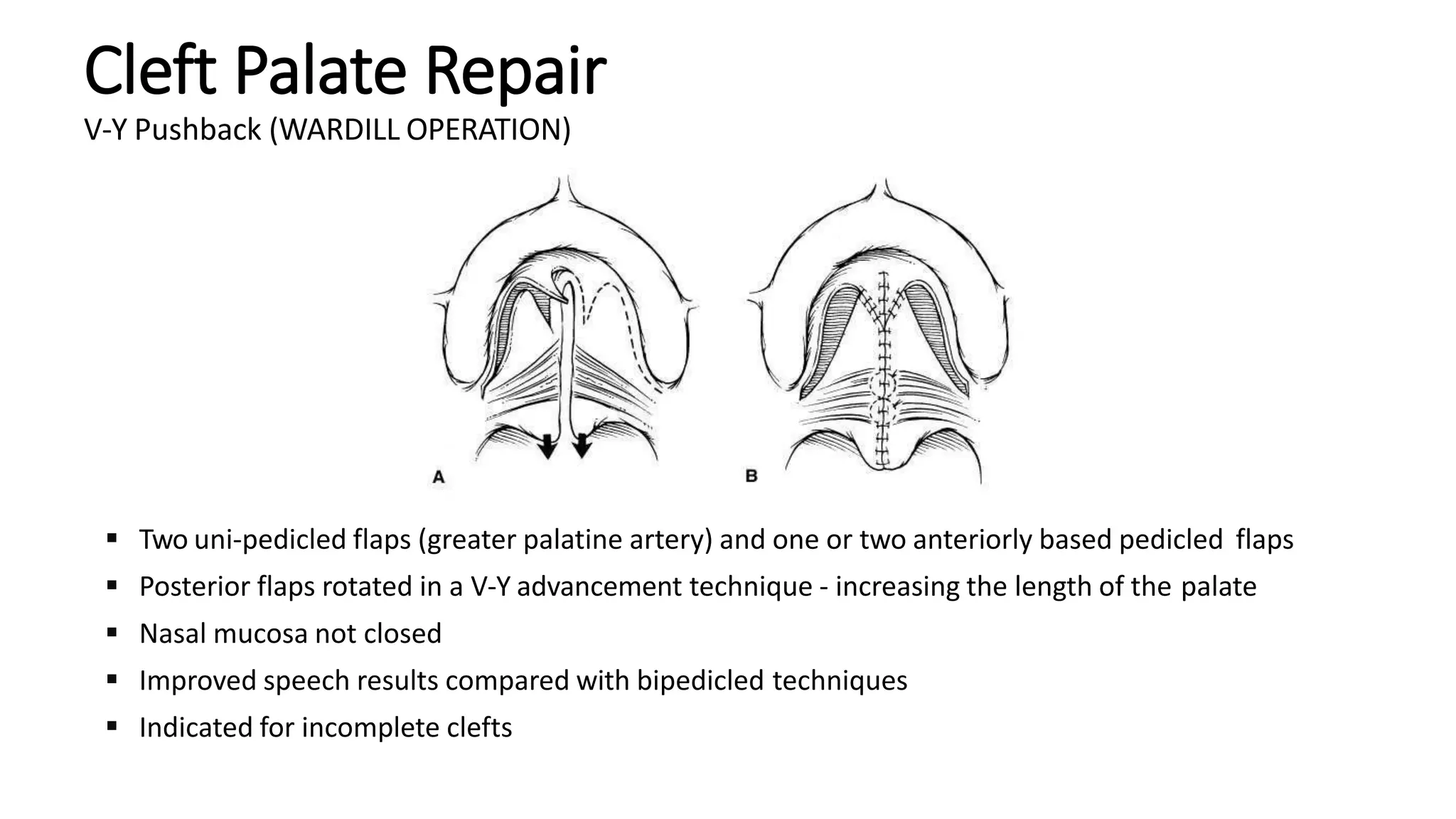 CLEFT LIP AND PALATE.pptx