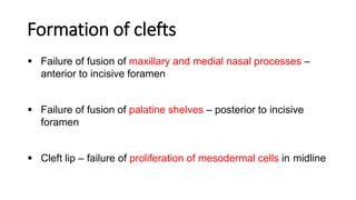 CLEFT LIP AND PALATE.pptx